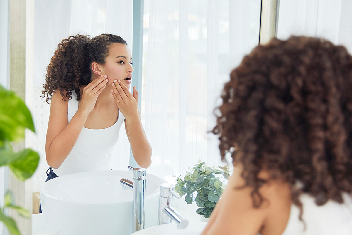 Acne | ReJoyce Aesthetics & Wellness